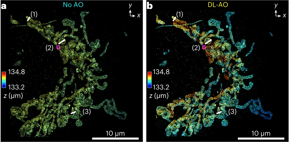Adaptive Optics Microscopy | Optical Microscopy